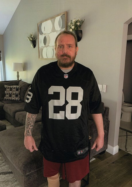 Matt Sammons Obituary - St. Louis, MO